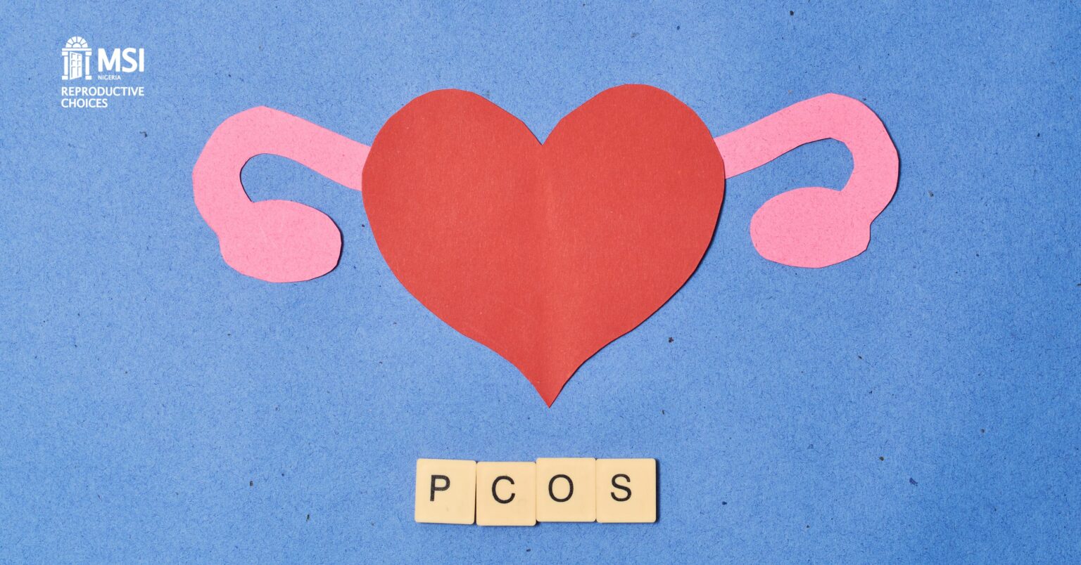 Understanding PCOS: Symptoms and When to Seek Help - MSI Nigeria ...
